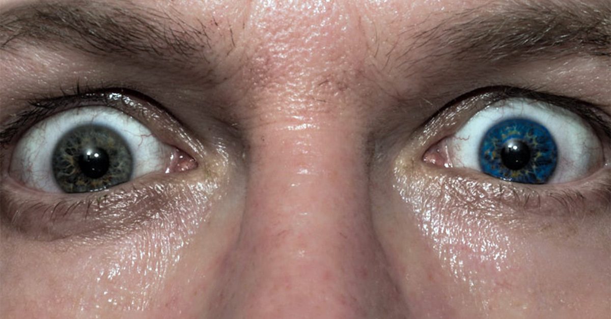 Tag der Iris-Heterochromie - Different Colored Eyes Day USA - 12. Juli