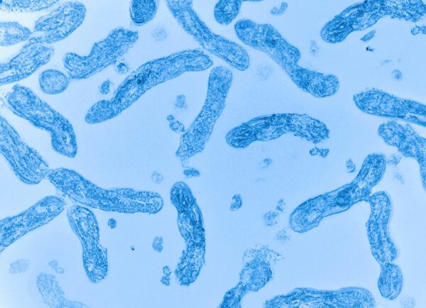 Tag der Kühlwasser-Legionellen + Tag der Kühlwasserhygiene in Deutschland - 19. August